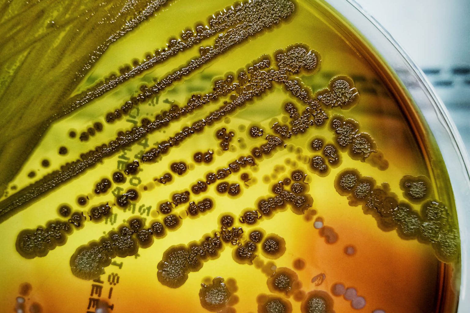 REVIEW: Acinetobacter baumannii Complex Infections: New Treatment ...